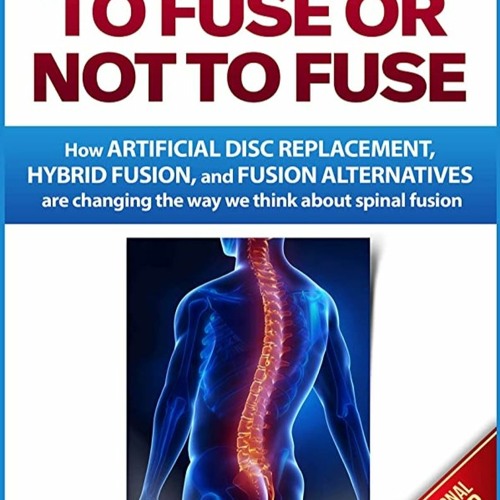 Stream ⚡download⚡* To Fuse or Not to Fuse: How Artificial Disc ...