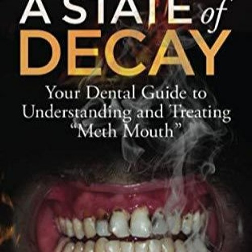 Stream episode [PDF READ ONLINE] A State of Decay: Your Dental Guide to ...