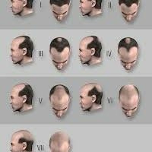 Stream madwhite(diss)calvice(prod.Young Naro777) by Young Naro777 👽🛸 ...