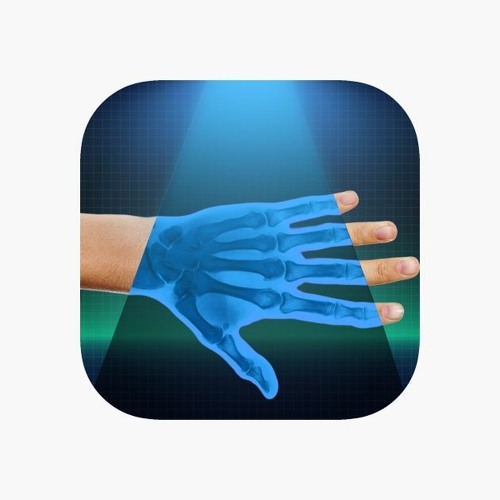 Stream X Ray Camera APK - The Most Realistic and Fun X-Ray App for ...