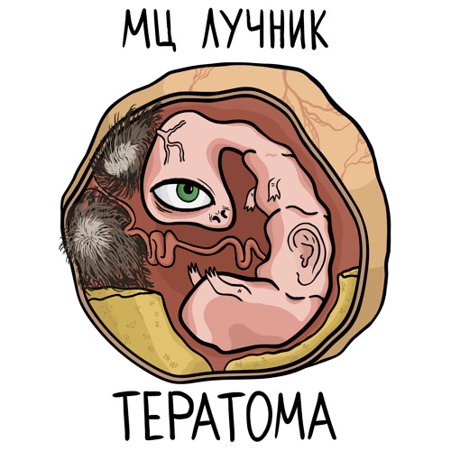 Stream Тератома by МЦ Лучник | Listen online for free on SoundCloud