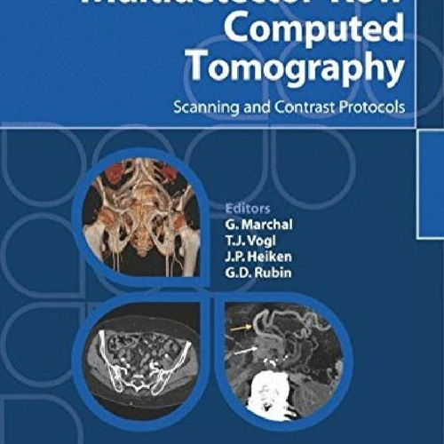 Stream DOWNLOAD/PDF Multidetector-Row Computed Tomography: Scanning and ...