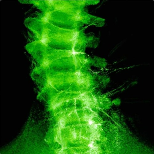 Stream BLACKED OUT by BONELESS TERROR | Listen online for free on ...