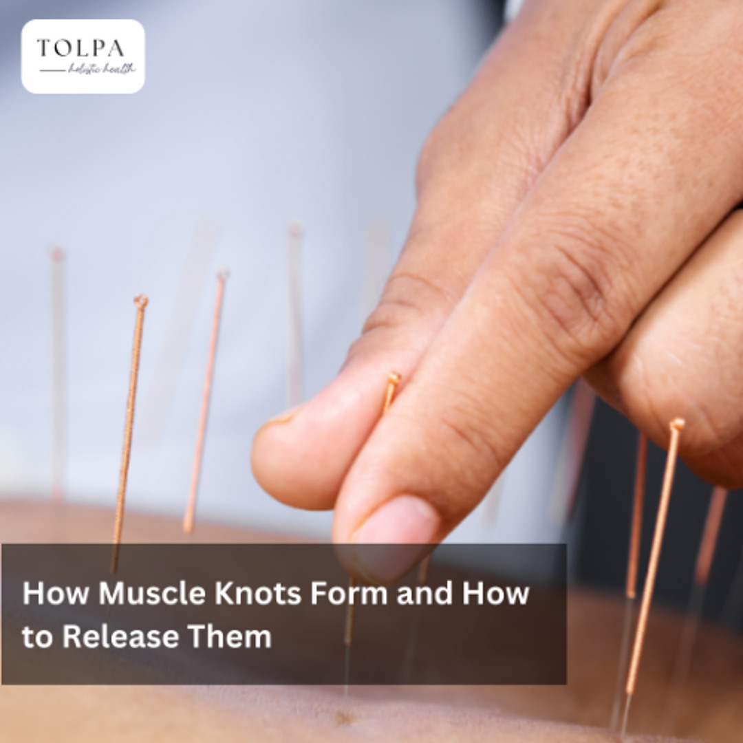 Stream How Muscle Knots Form and How to Release Them by Tolpa Holistic ...