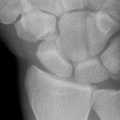 Stream My Hands Are Cut On The Crown Of Your Master by CNÁMHA | Listen ...