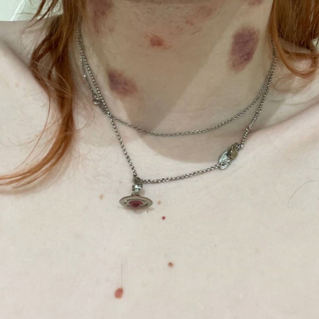 Stream #нотыврачи | Listen to xvii playlist online for free on SoundCloud