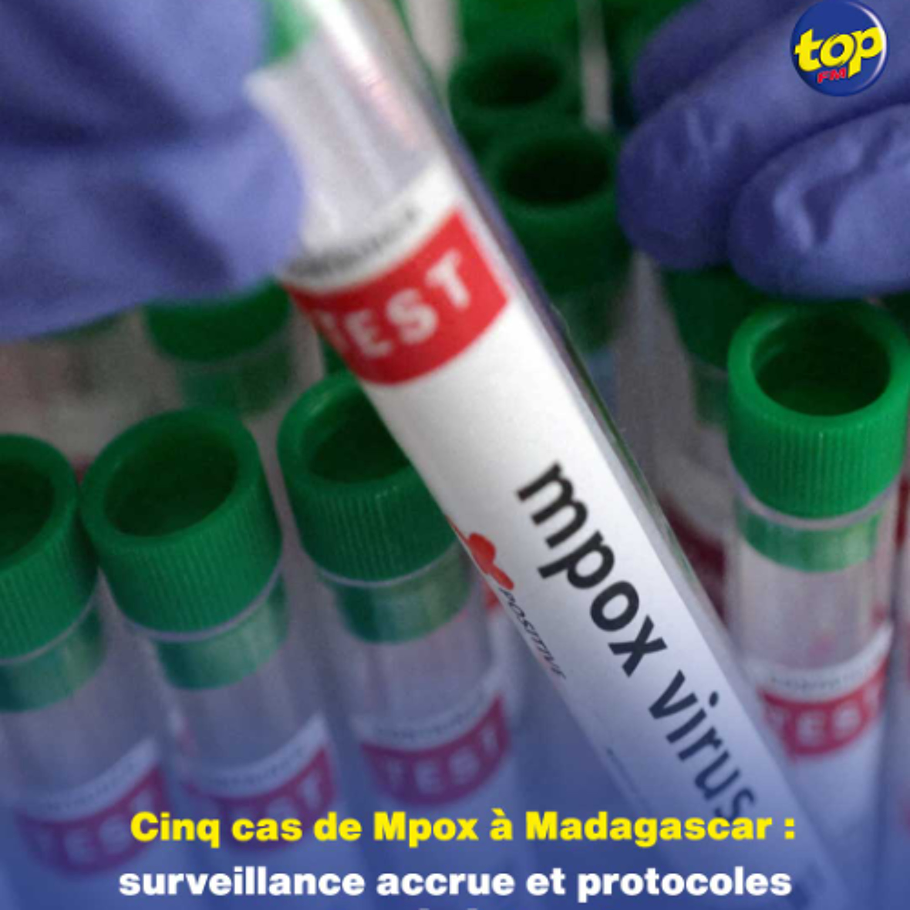 Cinq cas de Mpox à Madagascar : surveillance accrue et protocoles ...