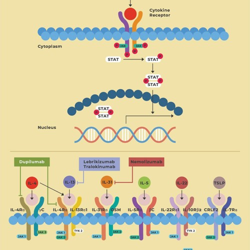 Stream episode What is type 2 inflammation & how it relates to ...