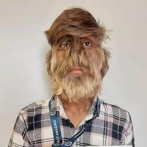 Stream Weird News Mar 18 2025; Movember Every Day, Itchy Trigger Paw ...