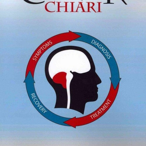 Stream episode Read Conquer Chiari: A Patient's Guide To The Chiari Malformation by ...