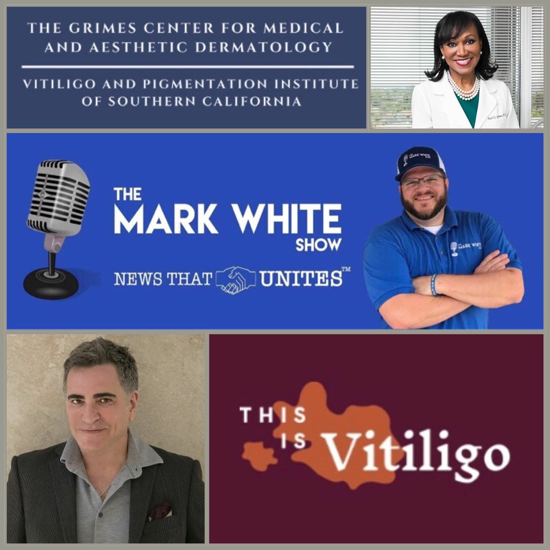 Stream episode Dr. Pearl Grimes & Neil Goetz Discuss Vitiligo by The ...