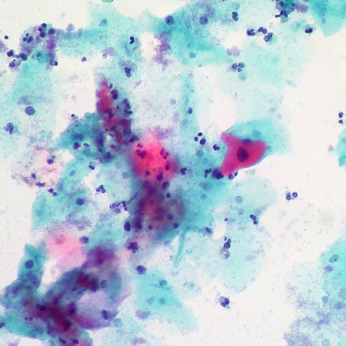 Stream Lil Tecca - Ransom (𝕵𝖊𝖘𝖘𝖊 𝕮𝖔𝖒𝖊𝖗 𝕽𝖊𝖒𝖎𝖝 𝕾𝖓𝖎𝖕𝖕𝖊𝖙) by Jesse Comer ...