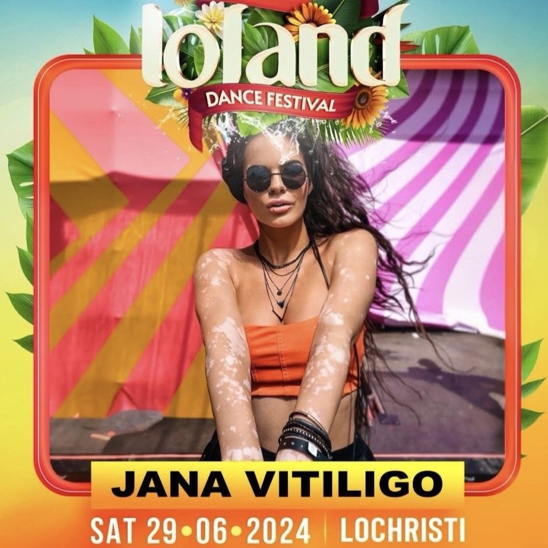 Stream Jana Vitiligo Live At Loland Festival 2024 by JANA VITILIGO | Listen online for free on ...