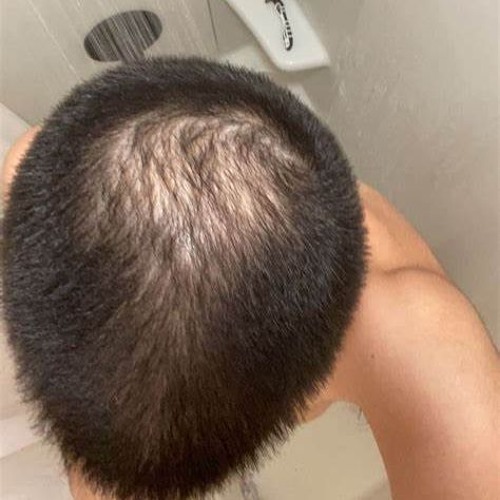 Stream Donald Trump Anthem - Dasgasdom3 ft PrTheFrog by dealdoe ...