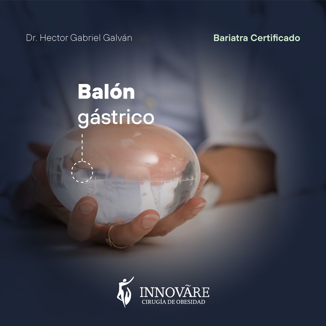 Stream episode Dr. Héctor Gabriel Galván Araiza | Balón intragástrico ...