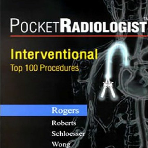Stream Pdf⚡️(read ️online) Pocket Radiologist: Interventional Top 100 ...