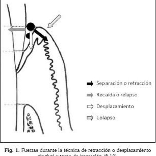 Stream episode Retraccion Gingival - Inzunza Castro Jennifer by ...