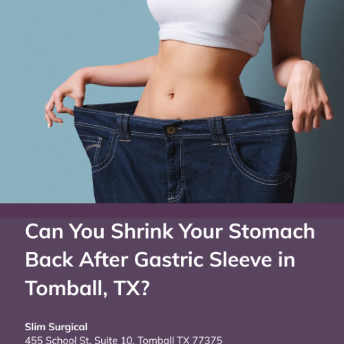 Stream Can You Shrink Your Stomach Back After Gastric Sleeve in Tomball ...