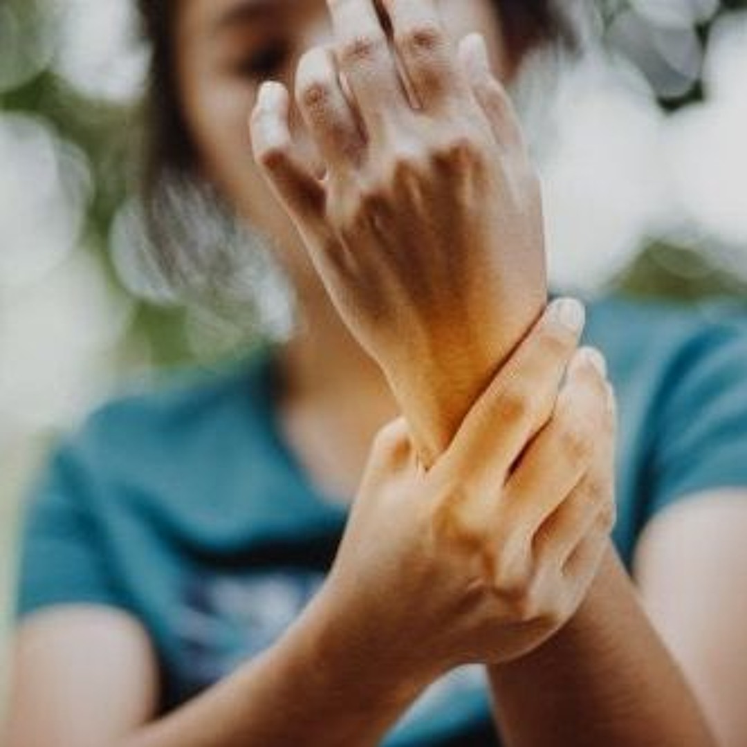 Stream Alien Hand Syndrome | Connie Lynn Culler by Connie Lynn Culler ...