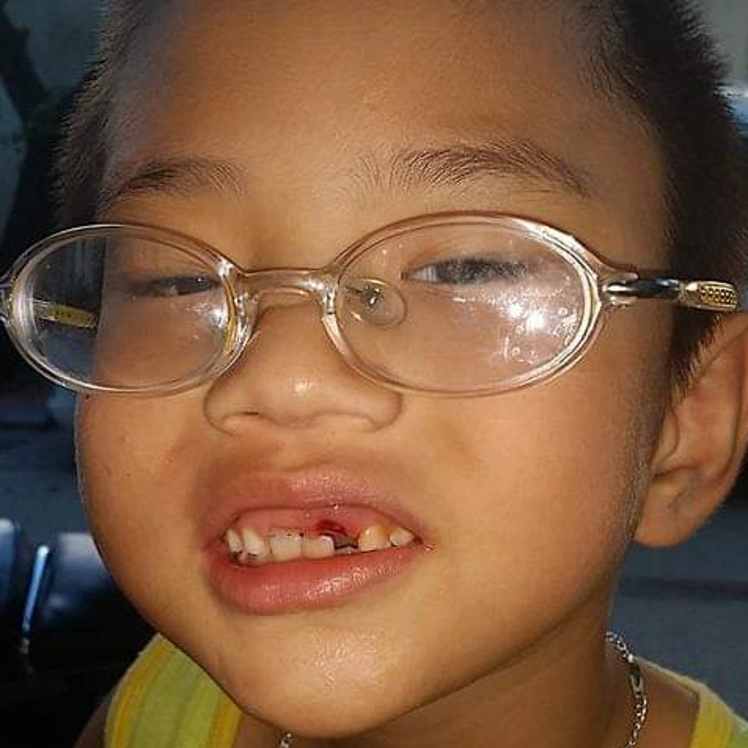 Stream DUNG LAM TRAI TIM A DAU REMAKE.TOIBIDIEN by hwngtran | Listen ...