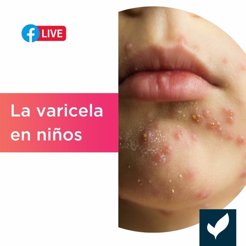 Stream En Femenino - La varicela en niños by Restauración 100.5 FM ...