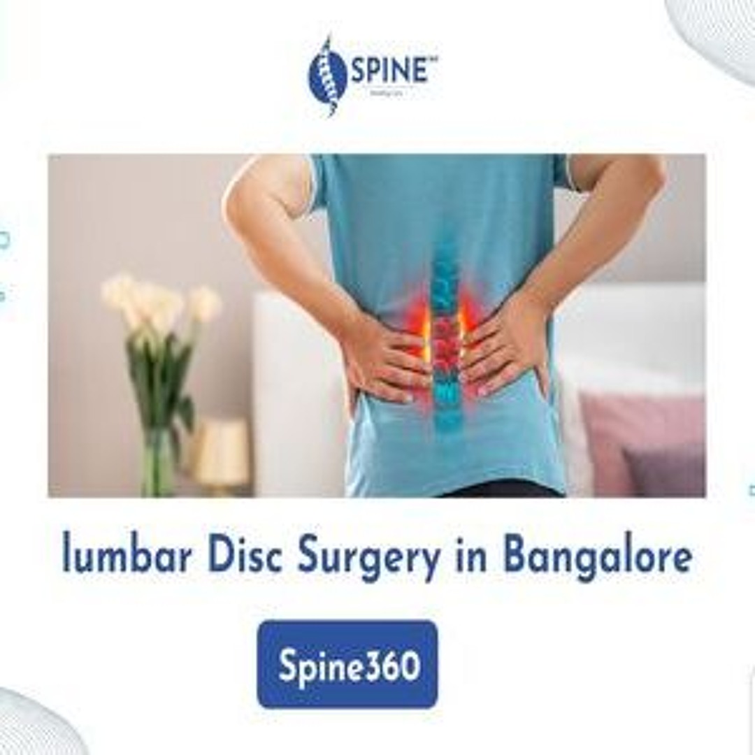 Stream Spine 360 | Listen to Lumbar disc surgery in Bangalore - Spine ...