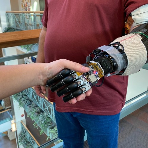 Stream episode From Amputee to Cyborg with this AI-Powered Hand! by ...