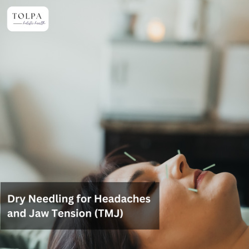 Stream Dry Needling for Headaches and Jaw Tension (TMJ) by Tolpa ...