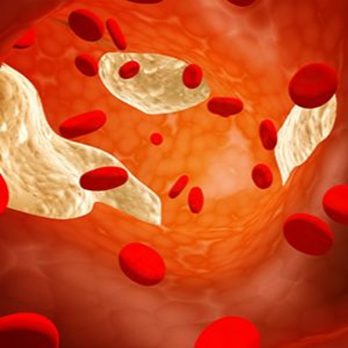 Stream "Understanding You: Cholesterol" Audition from Jhall | Listen ...