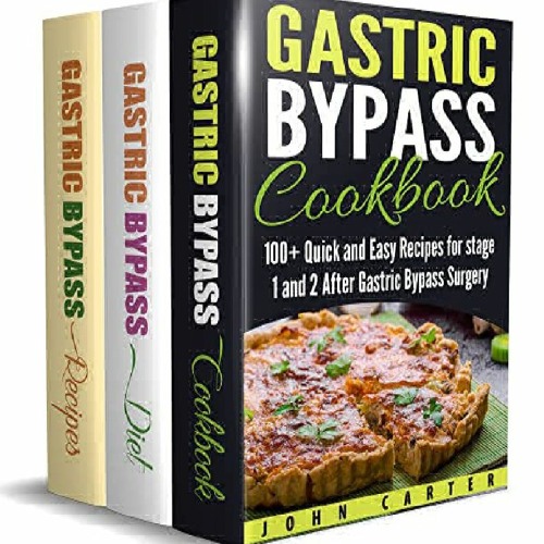 Stream episode (PDF BOOK) Gastric Bypass: 3 in 1 Box Set - Gastric ...