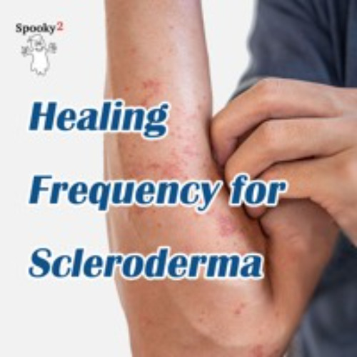 Stream Healing Frequencies For Scleroderma Or Systemic Sclerosis