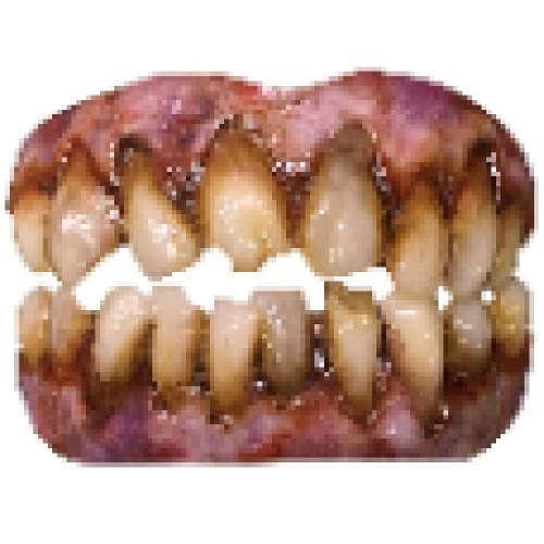 Stream teratoma monster by Prungler | Listen online for free on SoundCloud