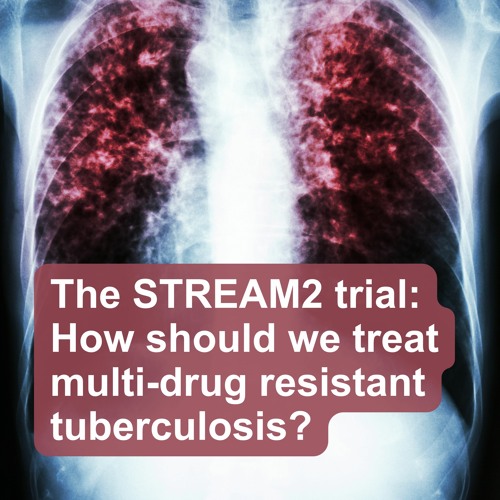 Stream episode The STREAM2 trial: How should we treat multi-drug ...