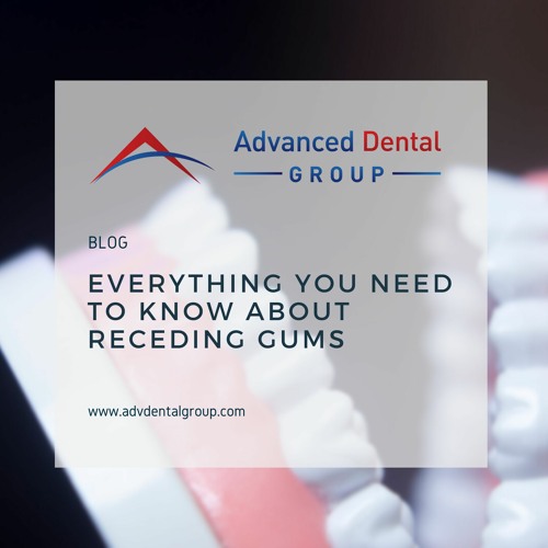 Stream Everything You Need to Know About Receding Gums by ADMS | Listen ... Stream Everything You Need to Know About Receding Gums by ADMS | Listen ...