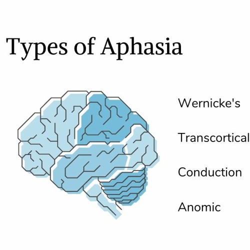 Stream Types of Aphasia - Blog Post by Atlas Aphasia Center | Listen ...