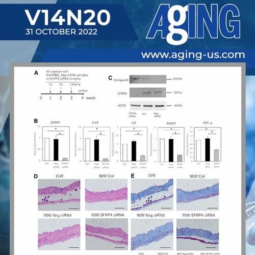 Stream episode Press Release: Downregulation of SASP by SFRP4 Knockdown Helps Prevent Skin Aging ...