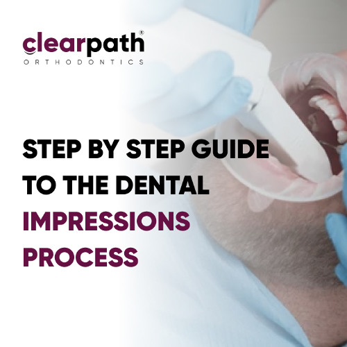Stream Dental Impressions_ A Step-by-Step Guide by ClearPath ...