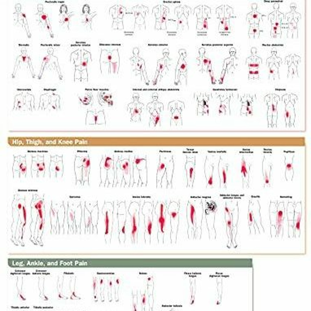 Stream episode kindle Travell, Simons & Simons? Trigger Point Pain ...
