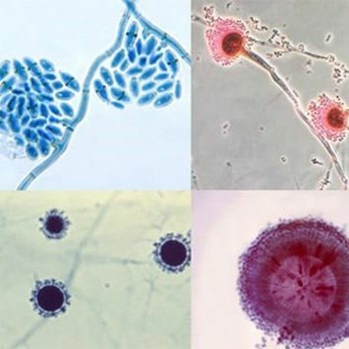 Stream MICOSIS: INFECCIONES PRODUCIDAS POR HONGOS by CINTYA DIAZ R ...