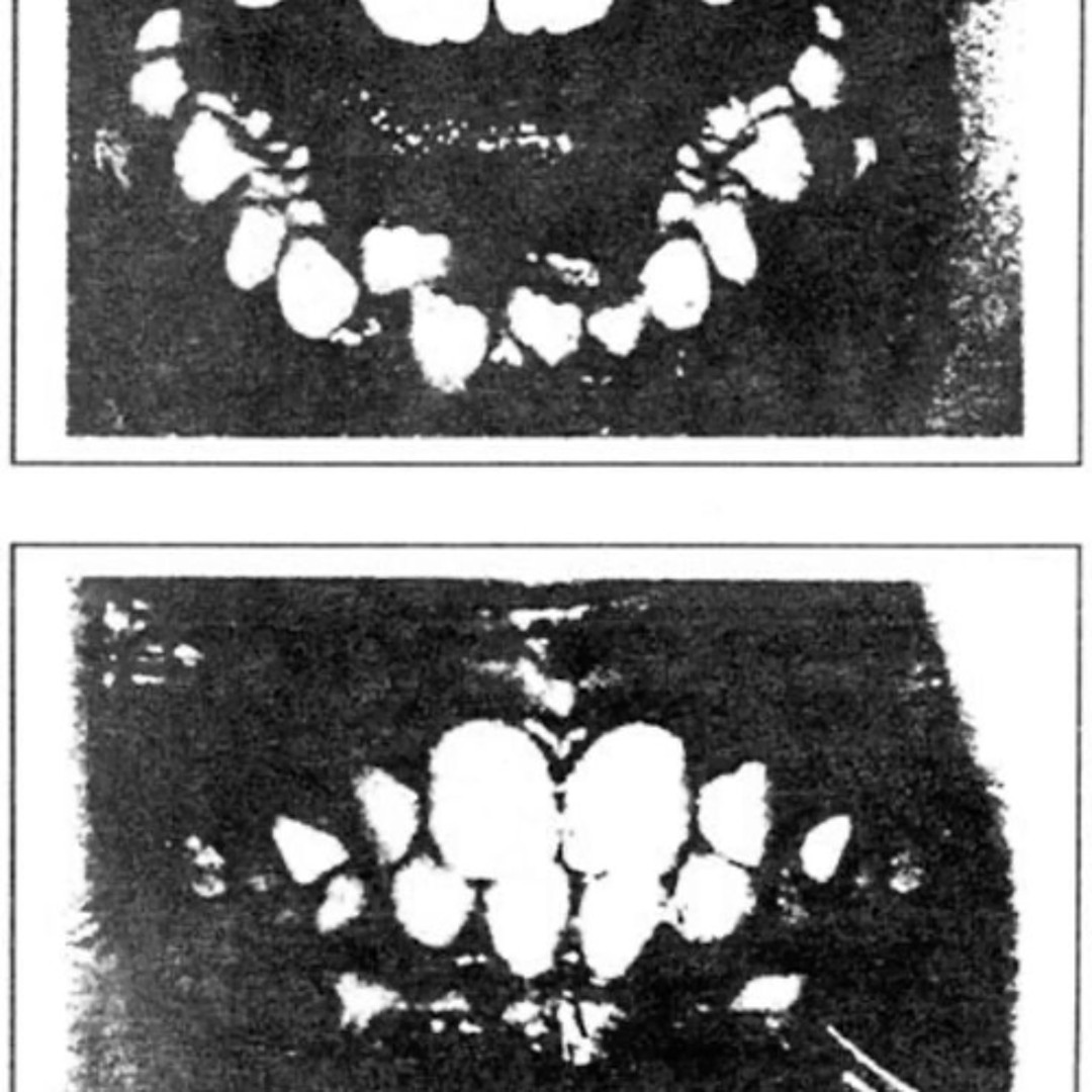 Stream Big Brain by Jovarre | Listen online for free on SoundCloud