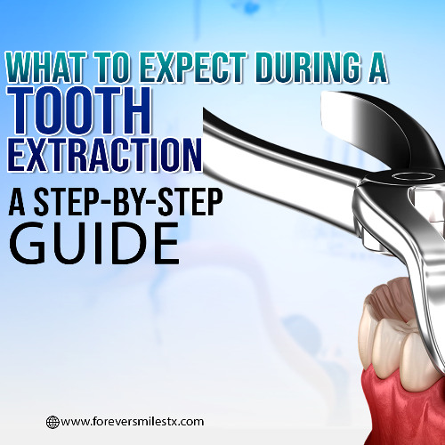 Stream What to Expect During a Tooth Extraction: A Step-by-Step Guide ...