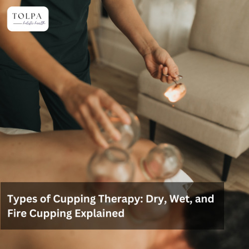 Stream Types of Cupping Therapy: Dry, Wet, and Fire Cupping Explained ...