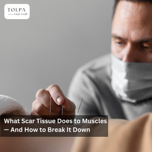 Stream What Scar Tissue Does to Muscles — And How to Break It Down by ...