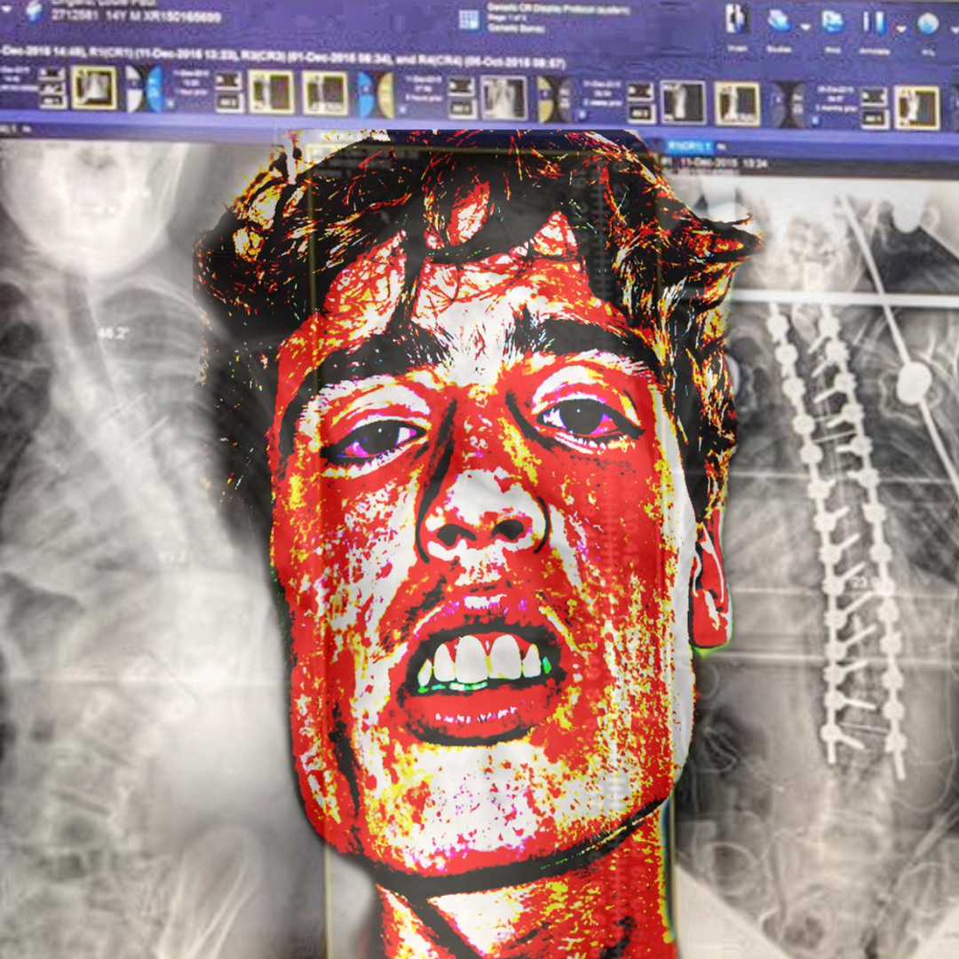 Stream scoliosis v2 (garage recordings) [prod. lil rozey] by notlewy ...