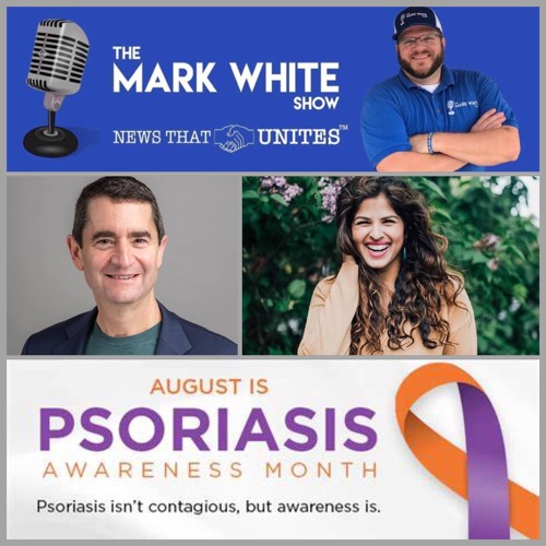 Stream episode Discussing Plaque Psoriasis with Dr. Bruce Strober ...