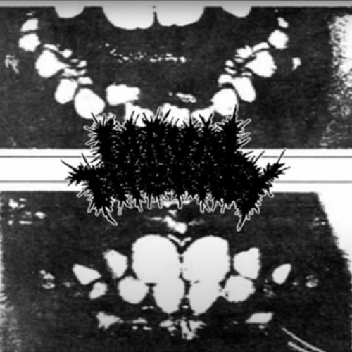 Stream Larval therapy Single (remastered) by LARVAL THERAPY | Listen ...