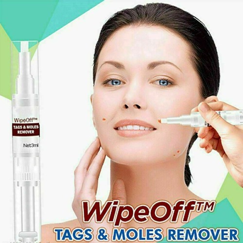 Stream Wipe Off Skin Tag Remover||Wipe Off Skin Tag Remover Reviews by ...