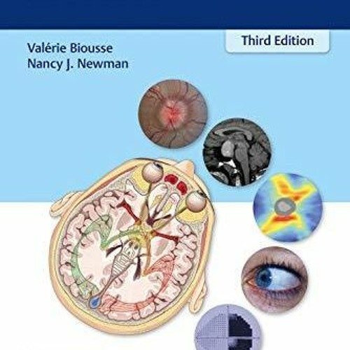 Stream episode PDF Neuro-Ophthalmology Illustrated free by Sammypearce ...