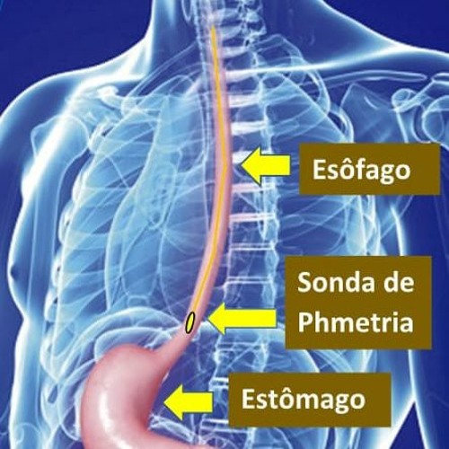 Stream Monitorización de pH del esófago by JUANA AYALA MURGUIA | Listen ...