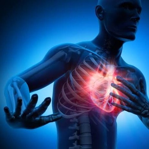 Stream heart attack [prod juju] by yonexd | Listen online for free on ...